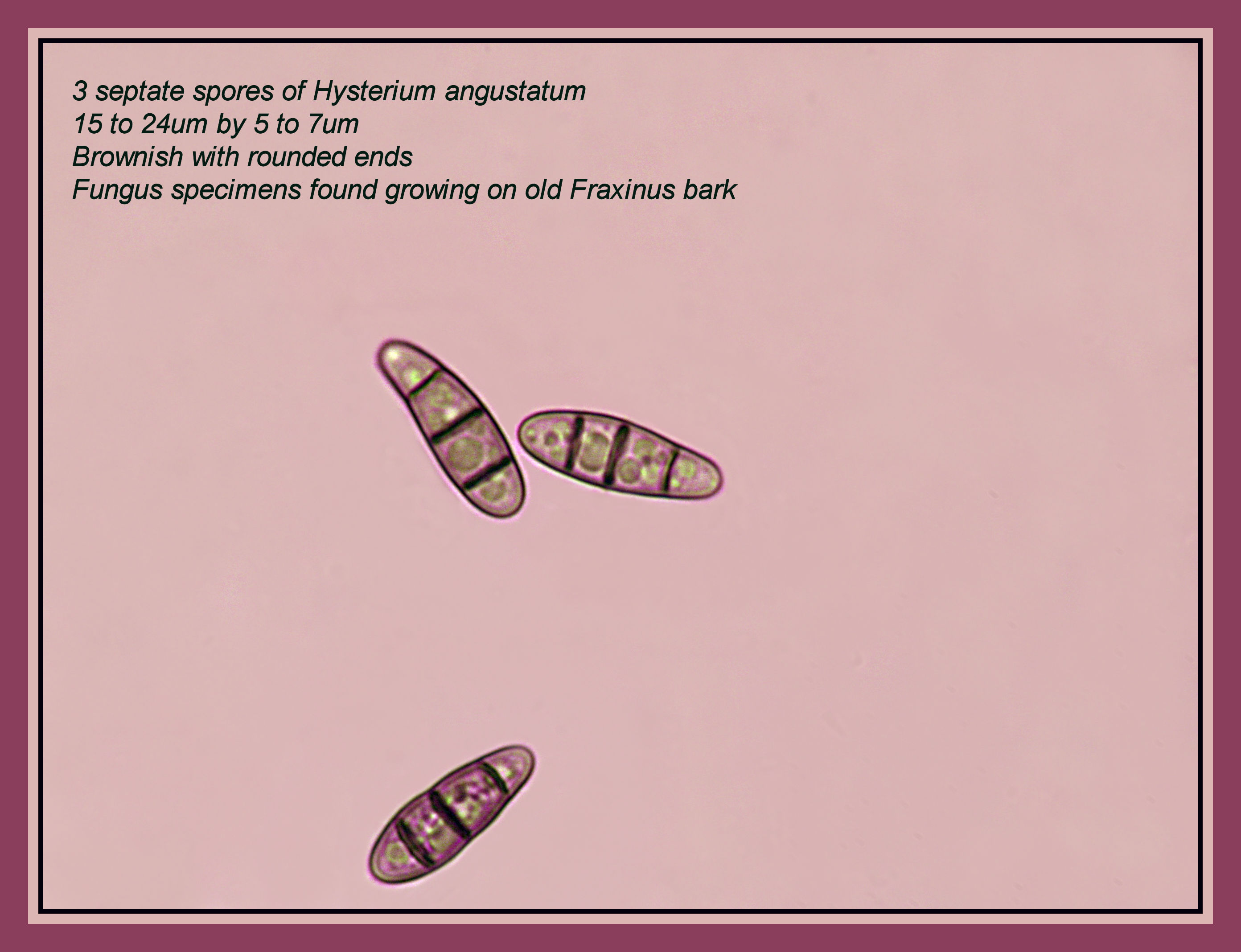 Fungal Sightings