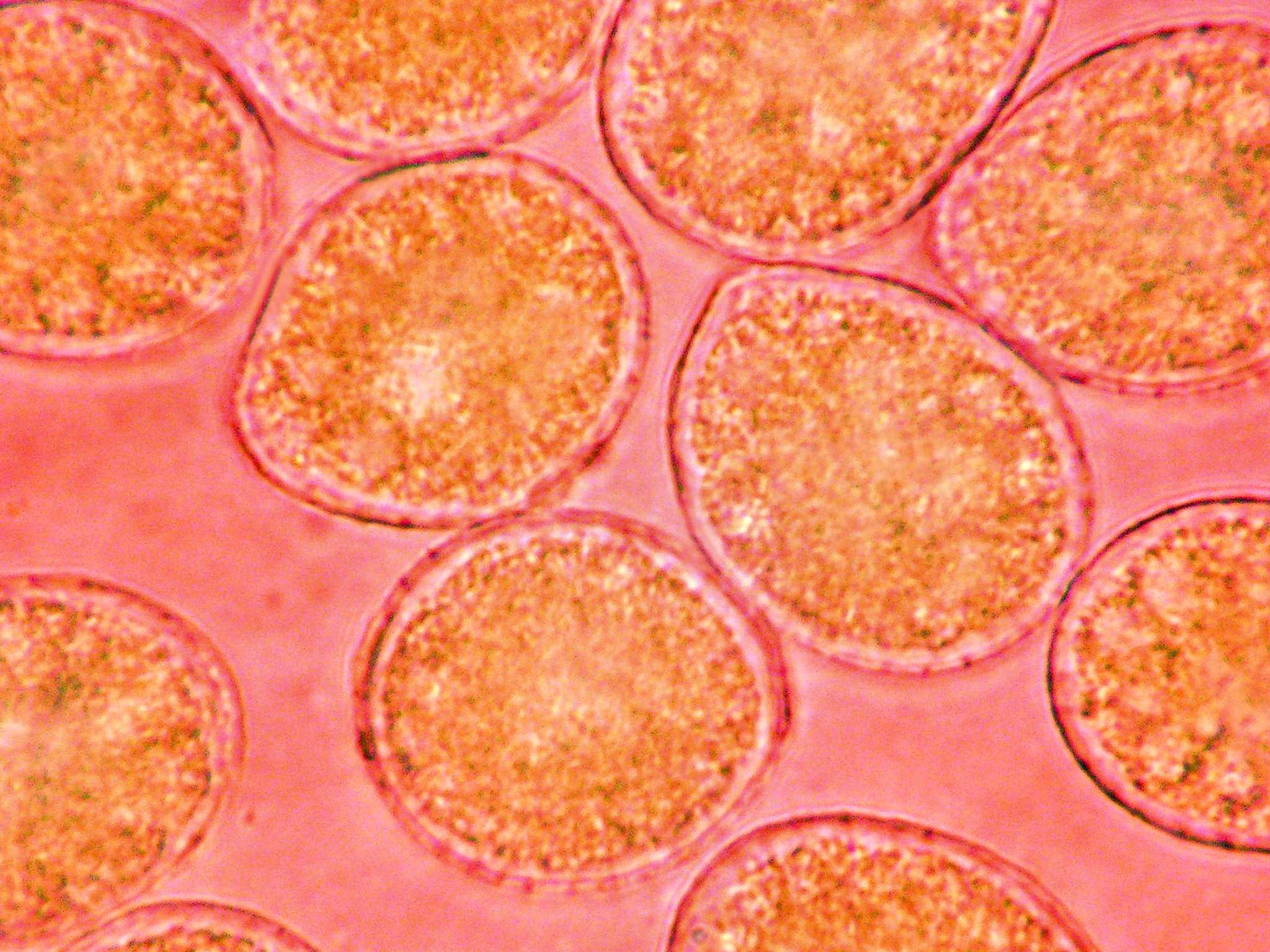 Melampsorella symphyti